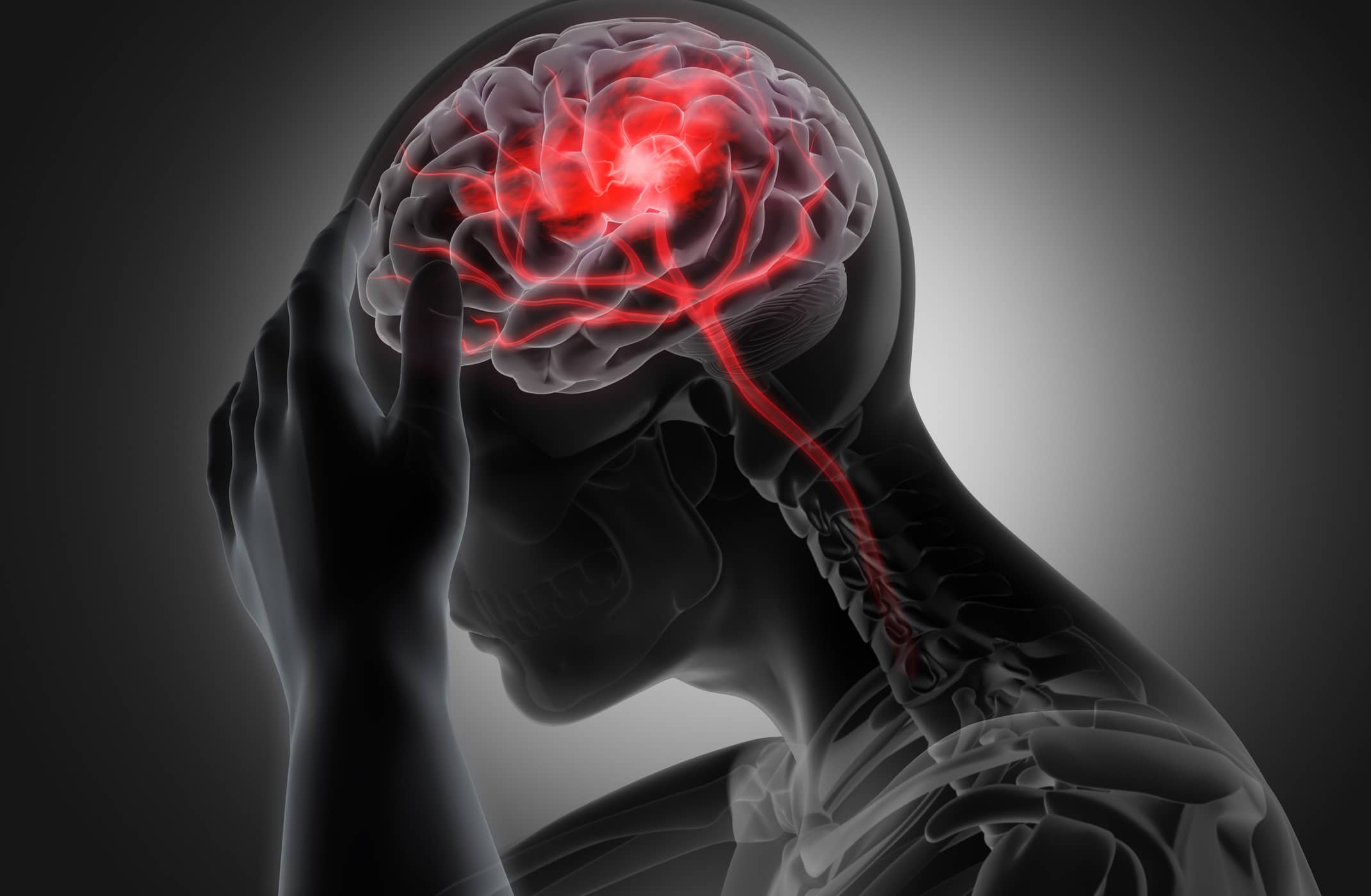 Proving a Traumatic Brain Injury